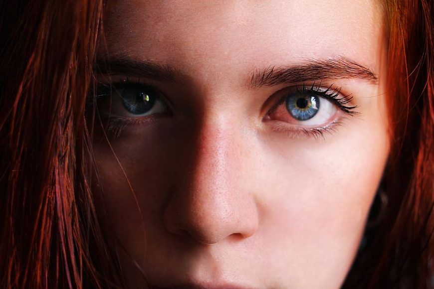 Pink Eye, What Is It And How To Fake Pink Eye? - Wellness Proposals